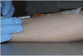 A.1.#TAB#Administration d’un test cutané à la tuberculine (TCT) et ...